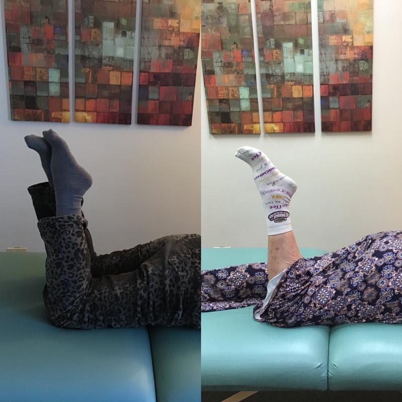 Post Procedure – Leg, Meet Your New Knee! - The Bridging Institute
